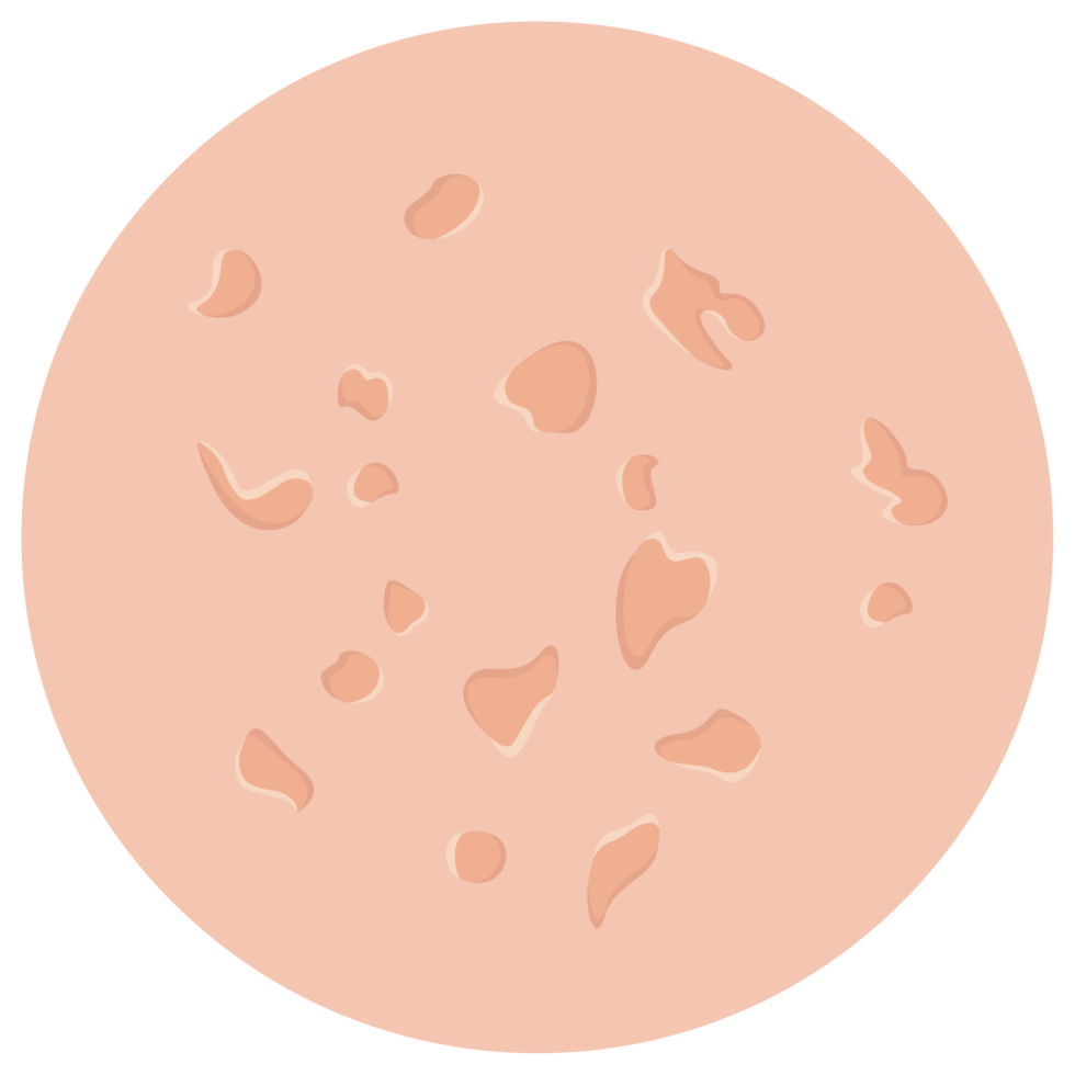 Narben: Ursache, Arten und Behandlung | octenisept®