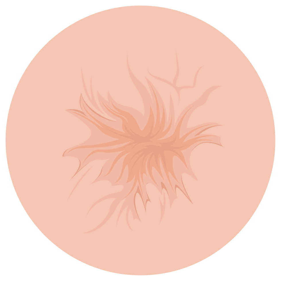 Narben: Ursache, Arten und Behandlung | octenisept®