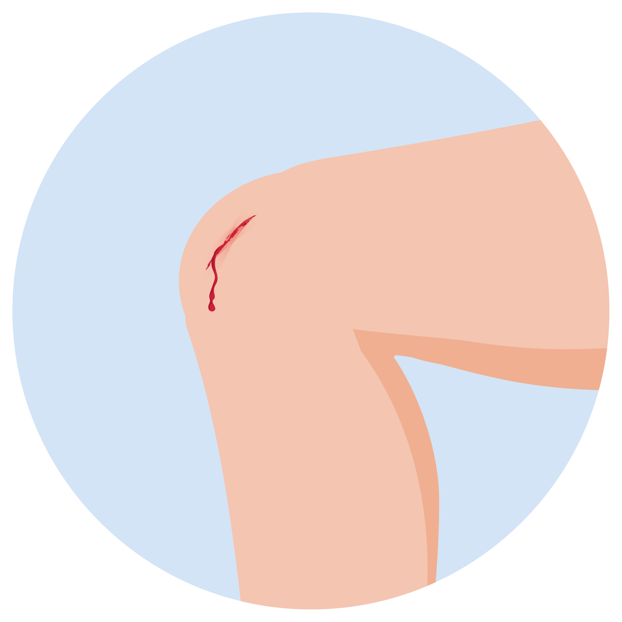 Platzwunden richtig versorgen: So geht´s | octenisept®